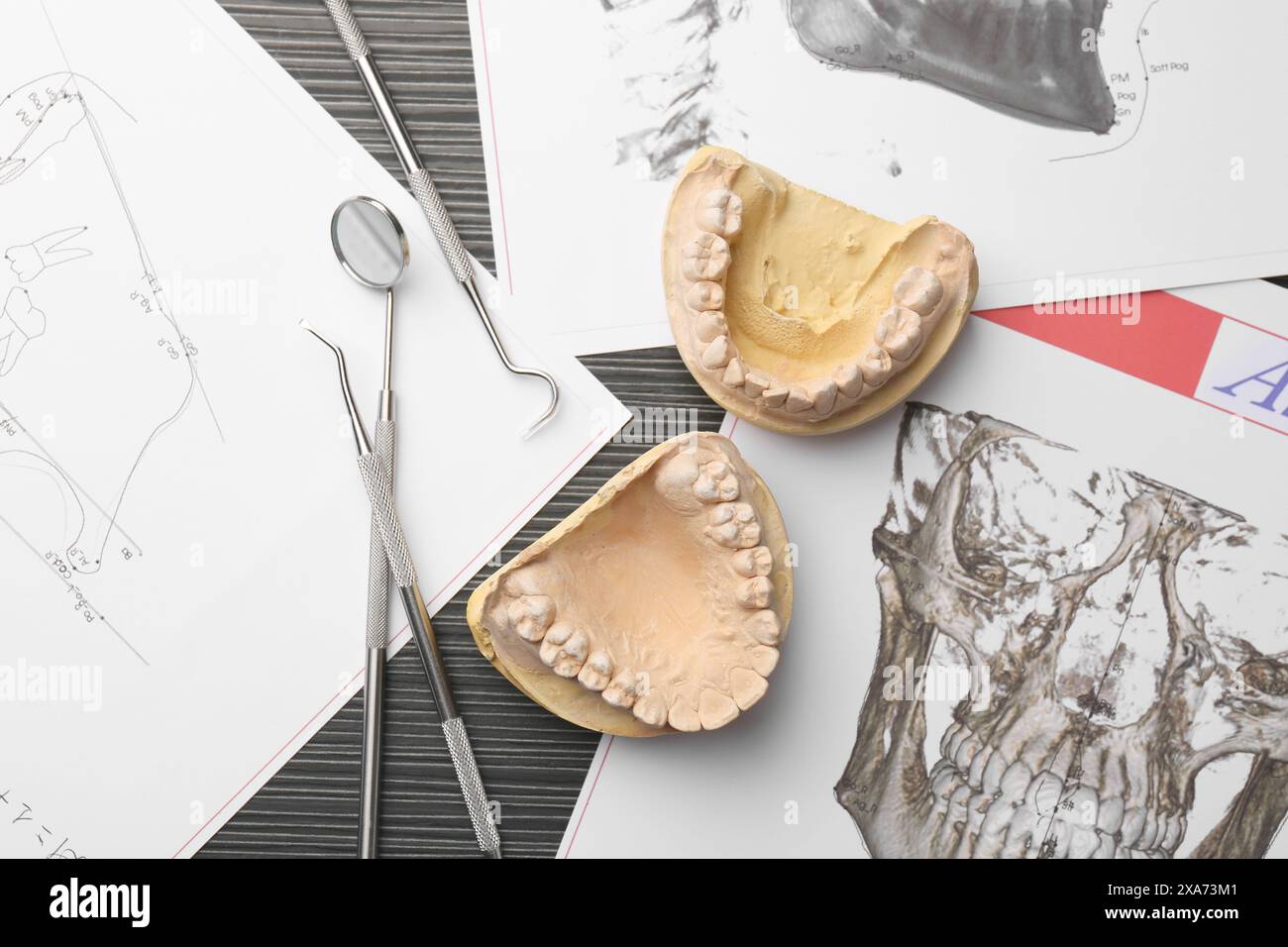 Dental model with gums, anatomy charts and dentist tools on grey wooden ...
