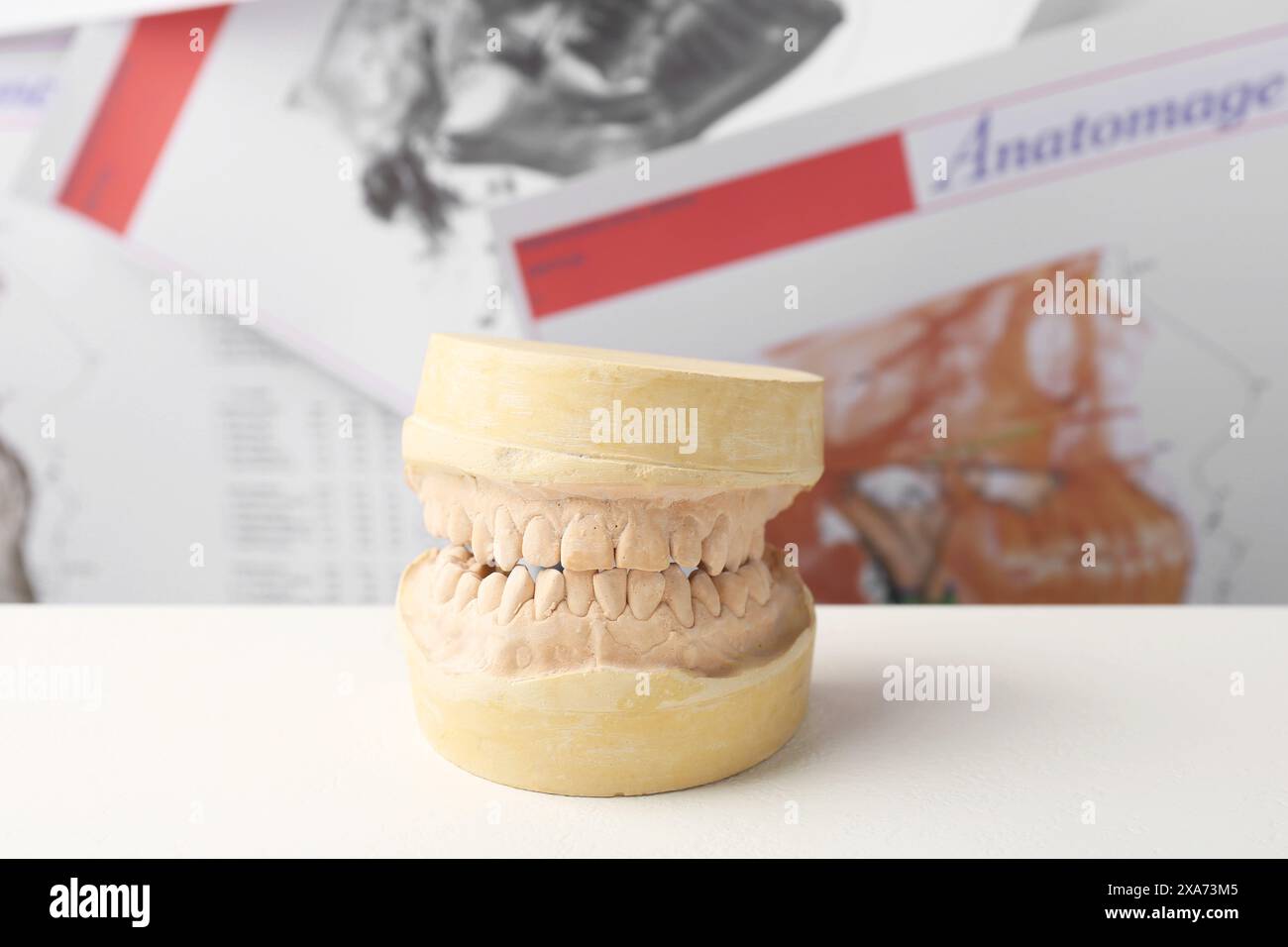 Dental model with gums on white table. Cast of teeth Stock Photo - Alamy