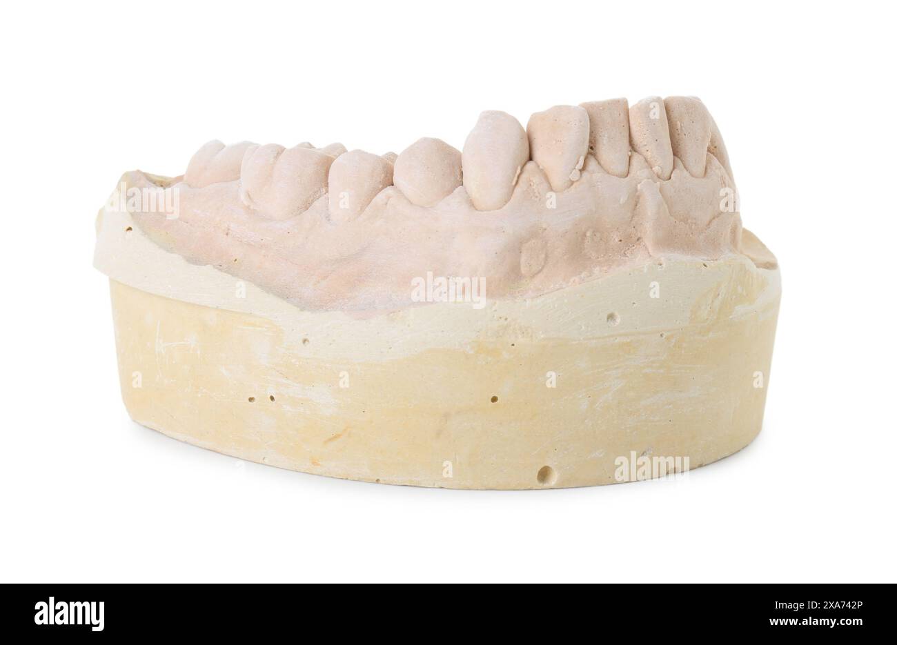 Dental model with jaw isolated on white. Cast of teeth Stock Photo - Alamy