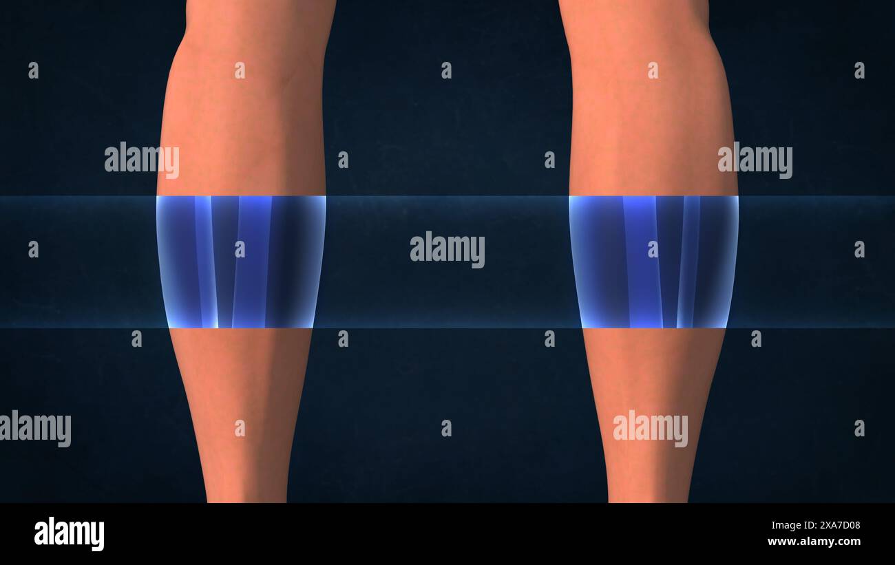 An X-ray of a human calf Stock Photo - Alamy