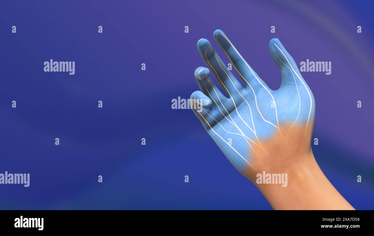 Symptoms of human hand nerves Stock Photo - Alamy