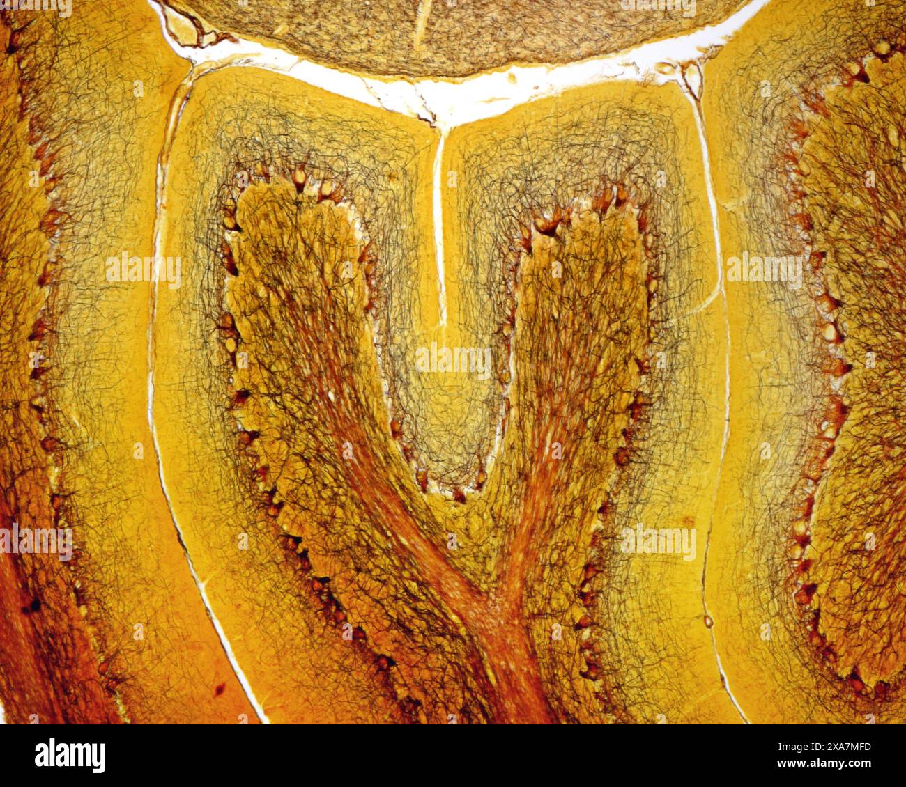 Light micrograph of cerebellar folia showing the three layers of ...