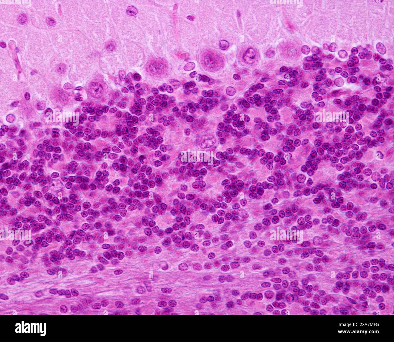 Light micrograph of the cerebellar cortex showing the Purkinje cell ...