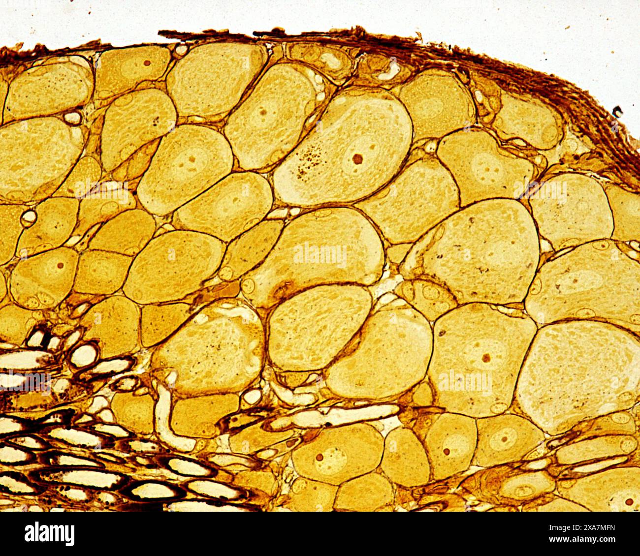 Light micrograph showing connective tissue stained with a silver method ...