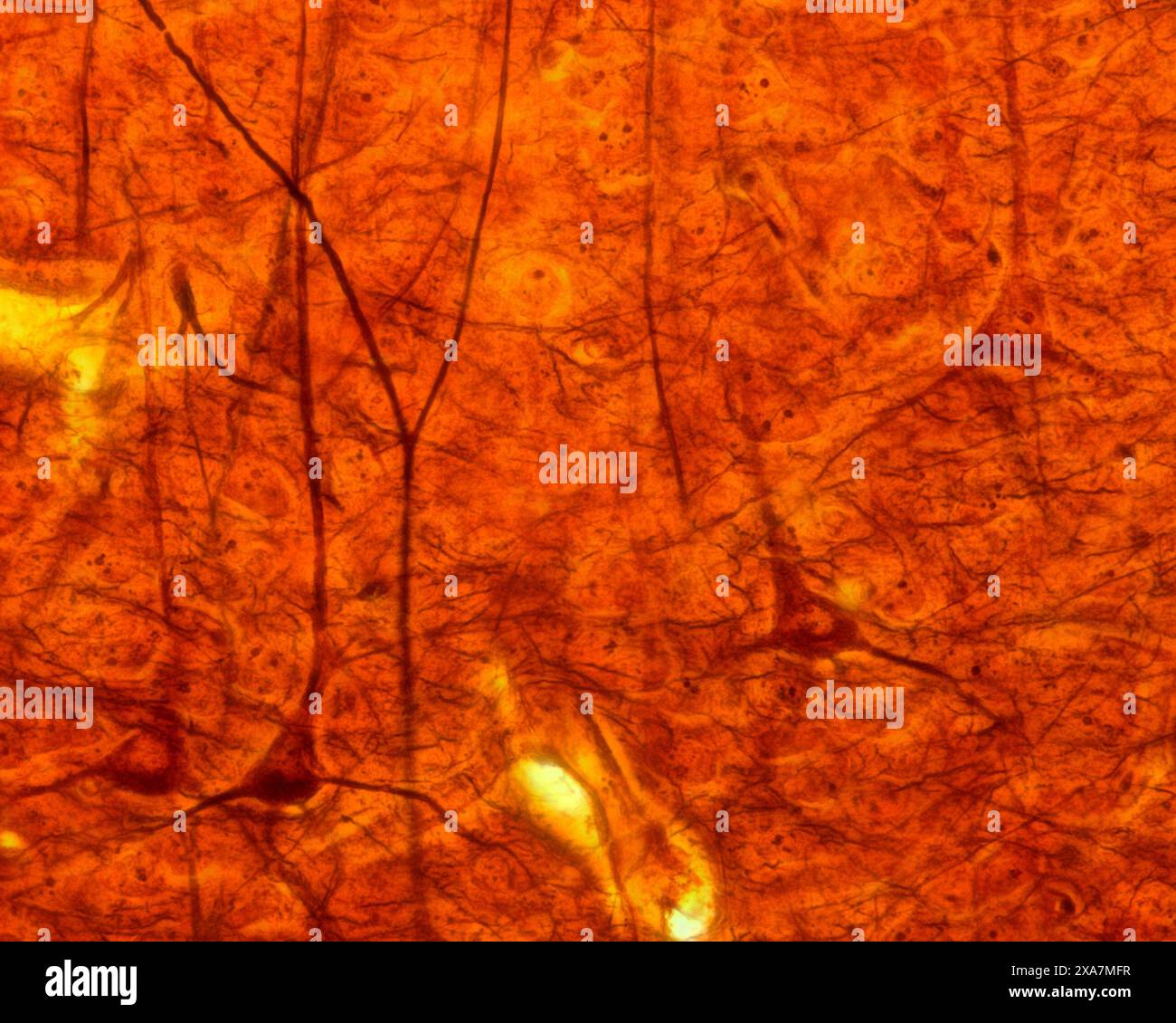 Light micrograph of the cerebral cortex stained with Cajal silver ...