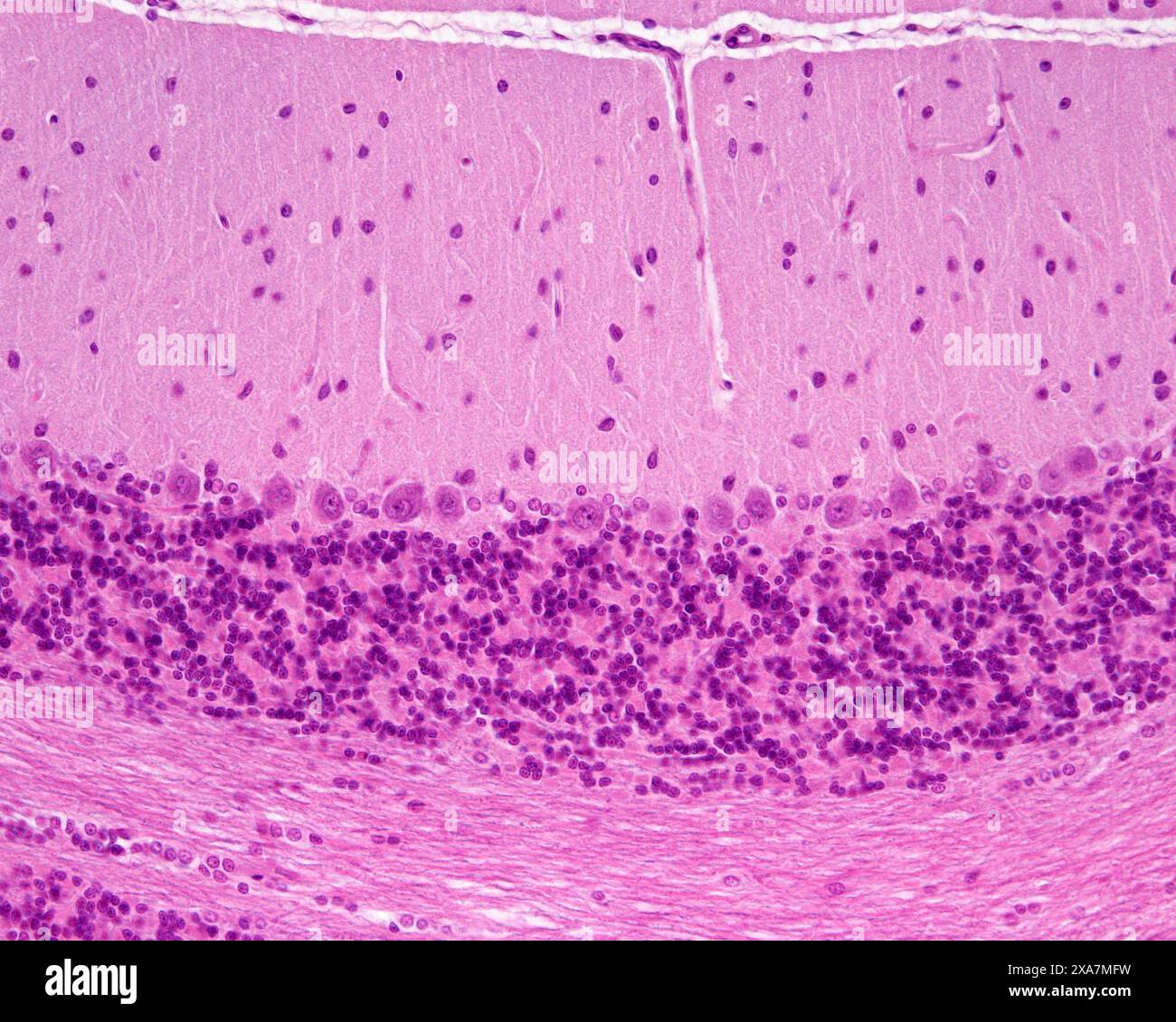 Light micrograph of the cerebellar cortex showing, from top: the ...