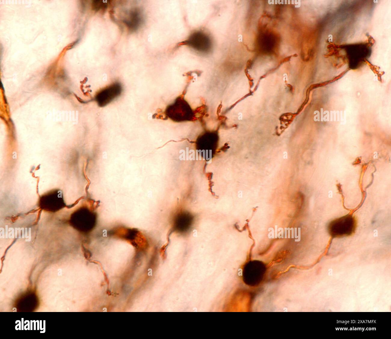 Light micrograph showing cerebellar granule cells stained with the ...