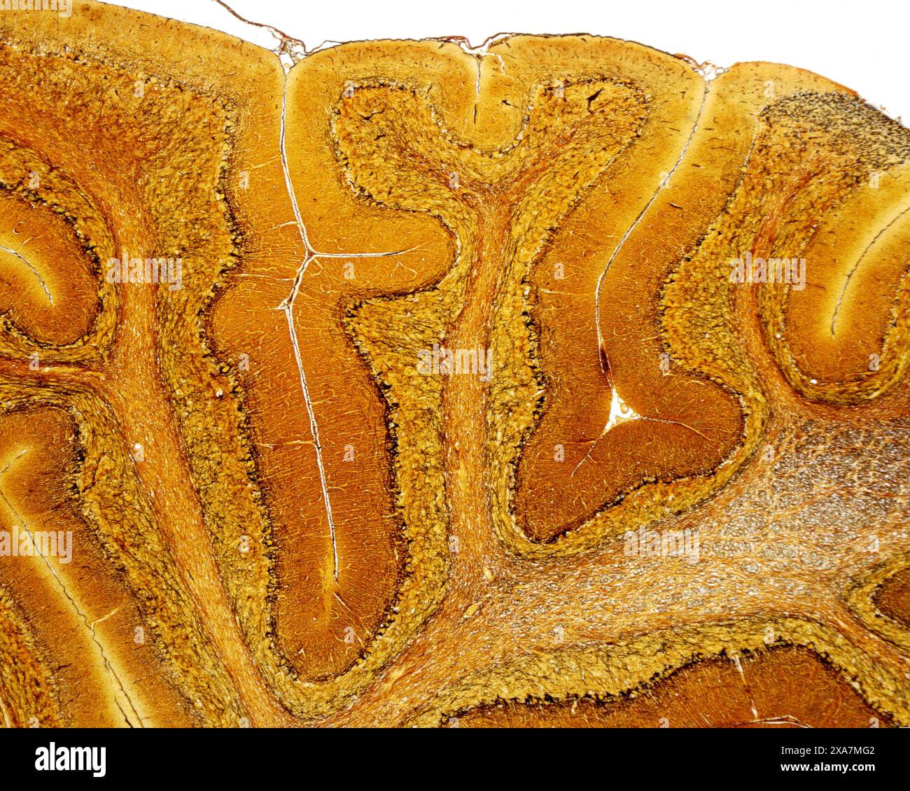 Light micrograph of the cerebellum. Each folium shows the three layers ...