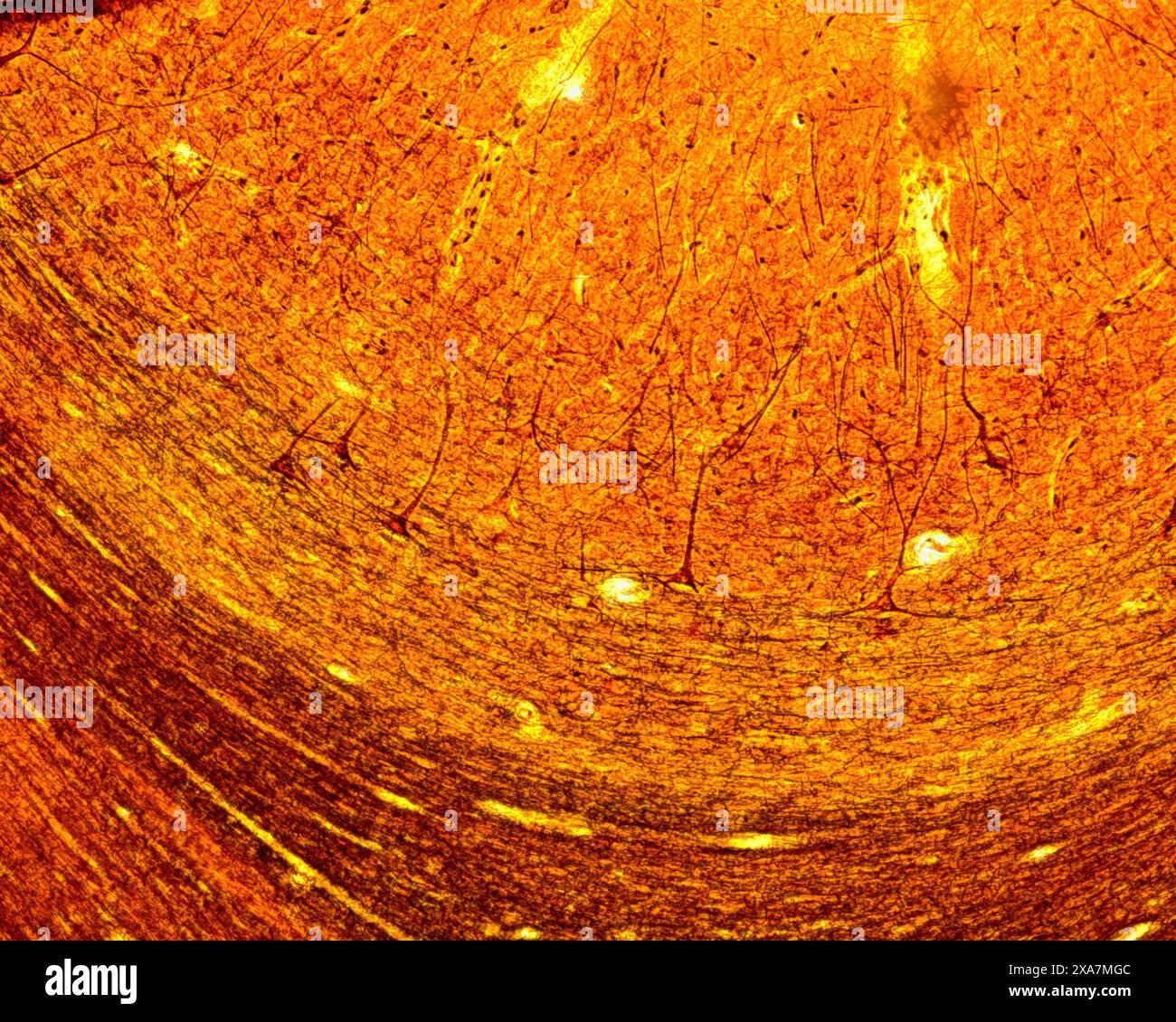 Light micrograph of the cerebral cortex stained with Cajal silver ...