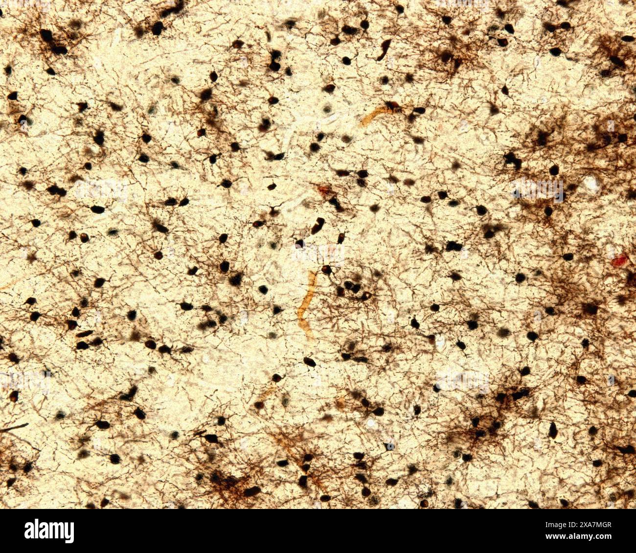 Light micrograph of oligodendroglia stained with the Rio-Hortega ...