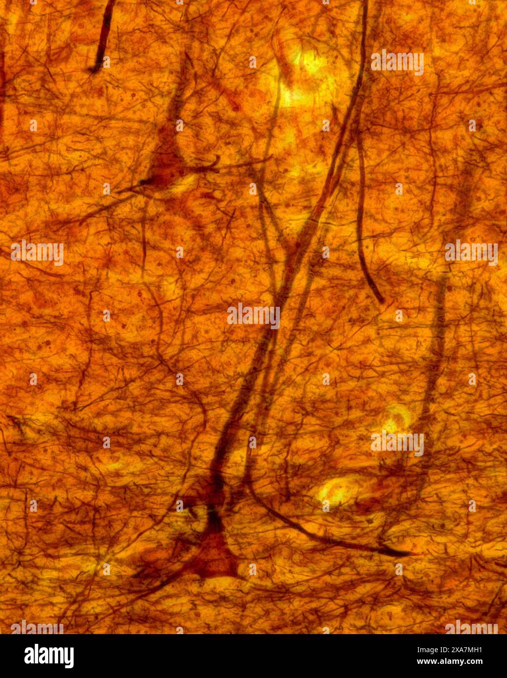 Light micrograph of the cerebral cortex stained with Cajal silver ...