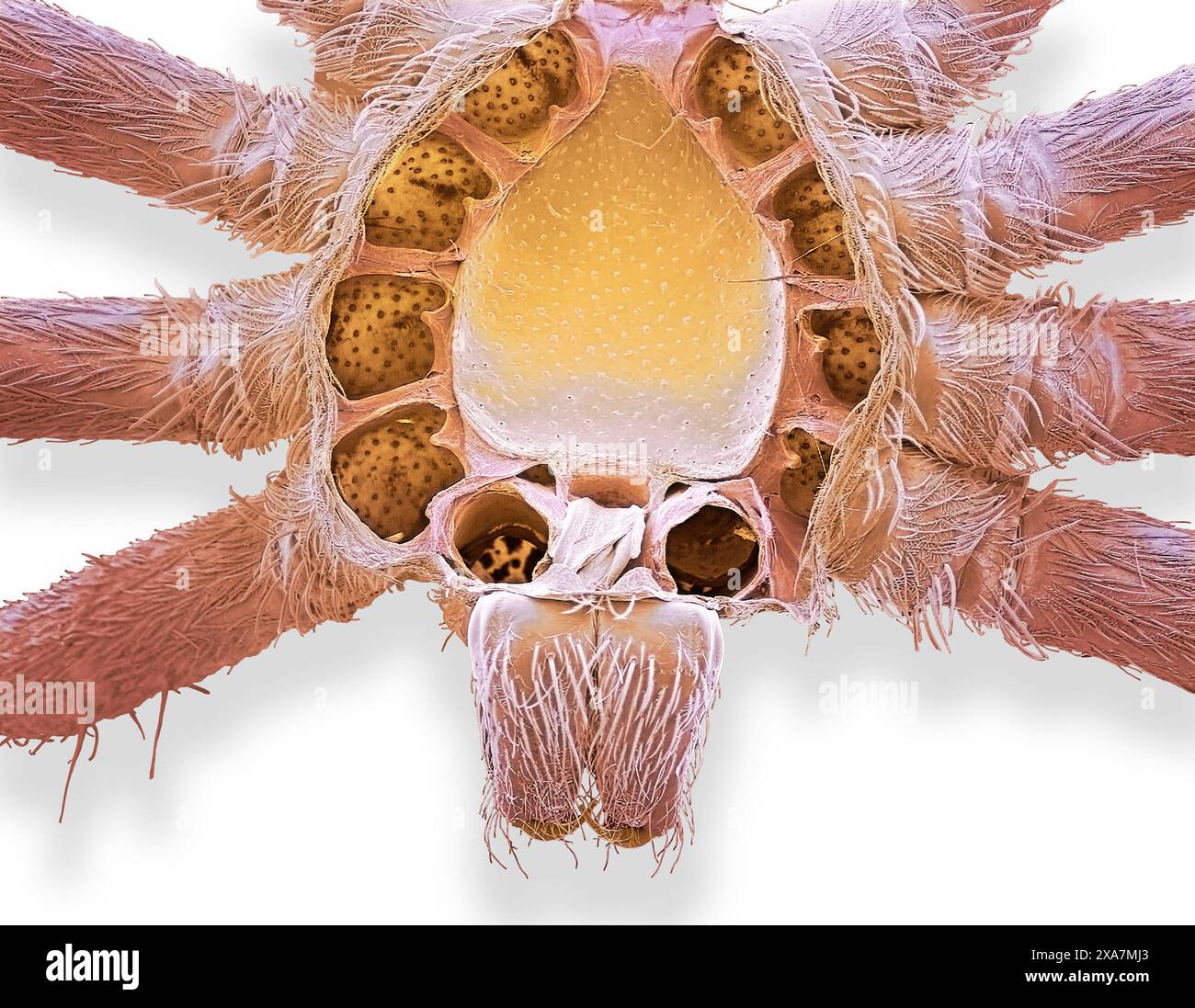 Spider exuvia. Coloured scanning electron micrograph (SEM). Molting is ...