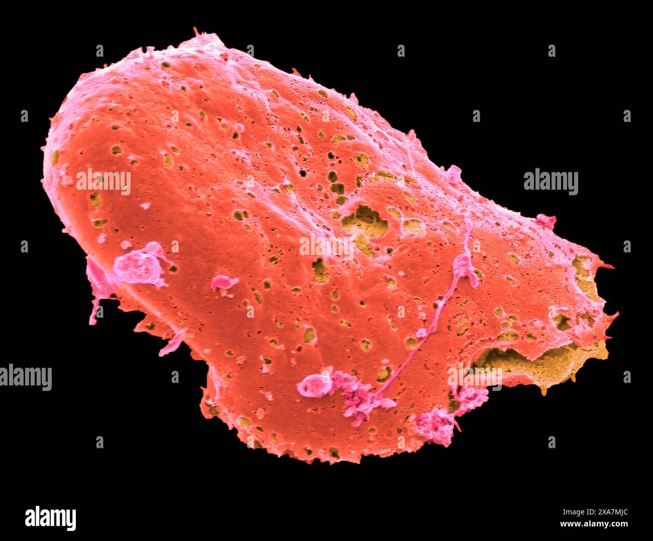 Viral necrosis. Coloured scanning electron micrograph (SEM) of a ...