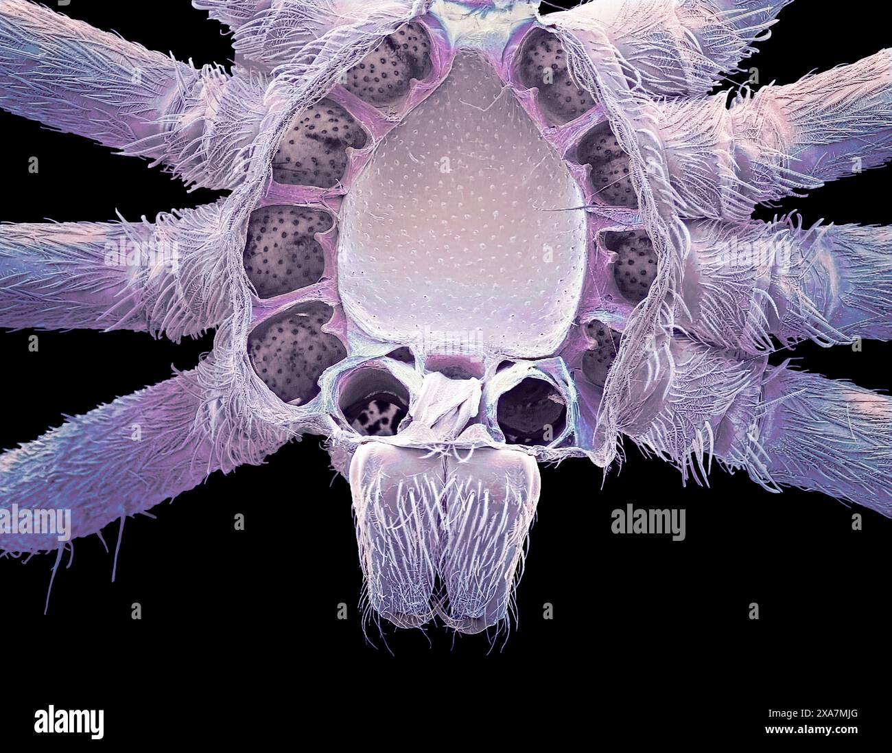 Spider exuvia. Coloured scanning electron micrograph (SEM). Molting is ...