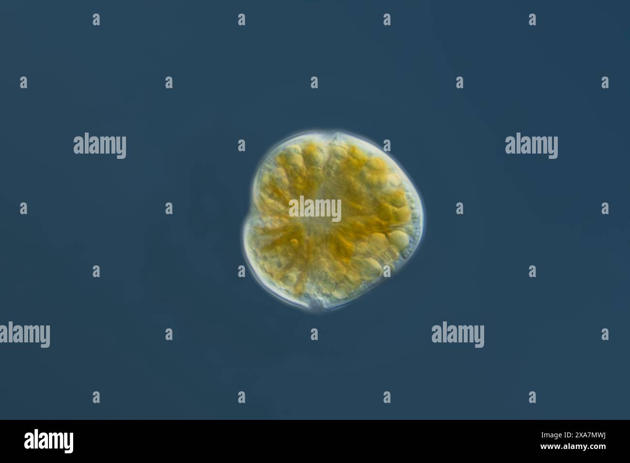 Differential interference contrast (DIC) light micrograph of ...