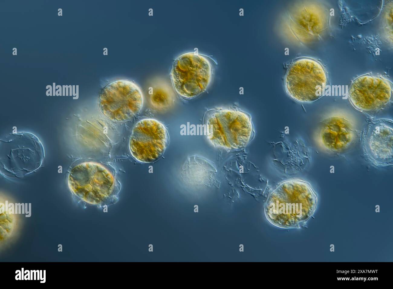 Differential interference contrast (DIC) light micrograph of ...