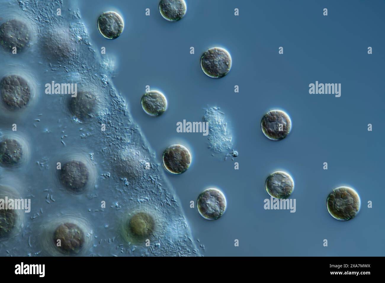 Differential interference contrast (DIC) light micrograph of Rhodella ...