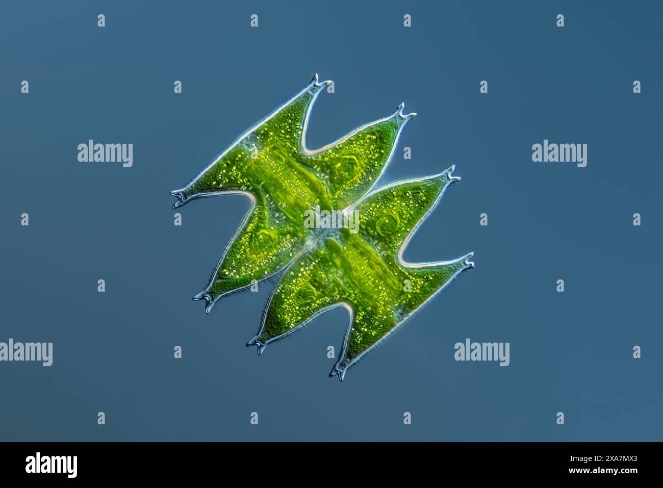 Differential interference contrast (DIC) light micrograph of a ...