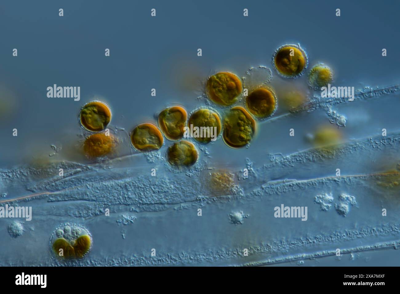 Differential interference contrast (DIC) light micrograph of Chrysotila ...