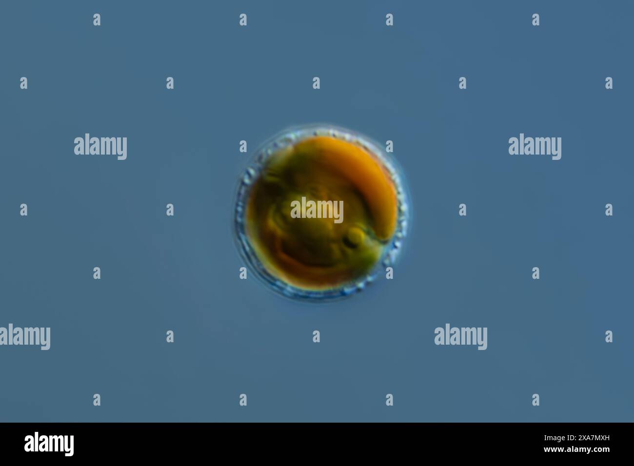 Differential interference contrast (DIC) light micrograph of Chrysotila ...