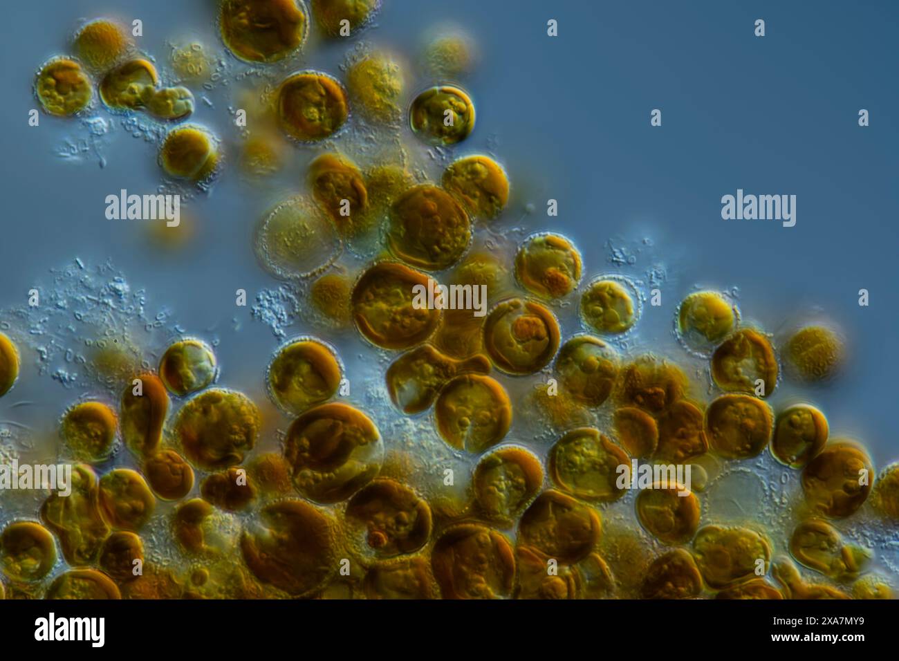Differential interference contrast (DIC) light micrograph of Chrysotila ...