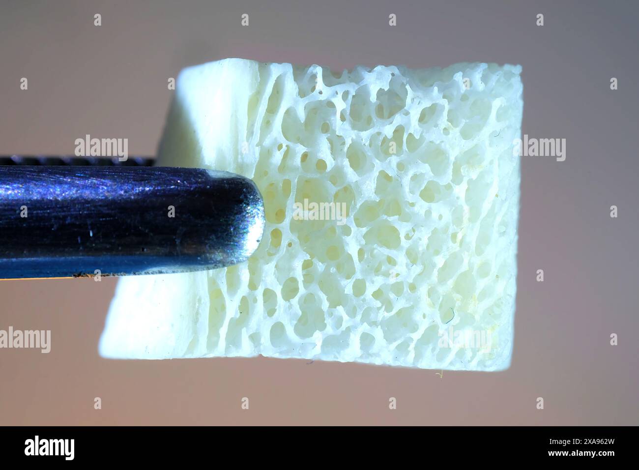 Porous Bonegraft Biomaterials Stock Photo - Alamy