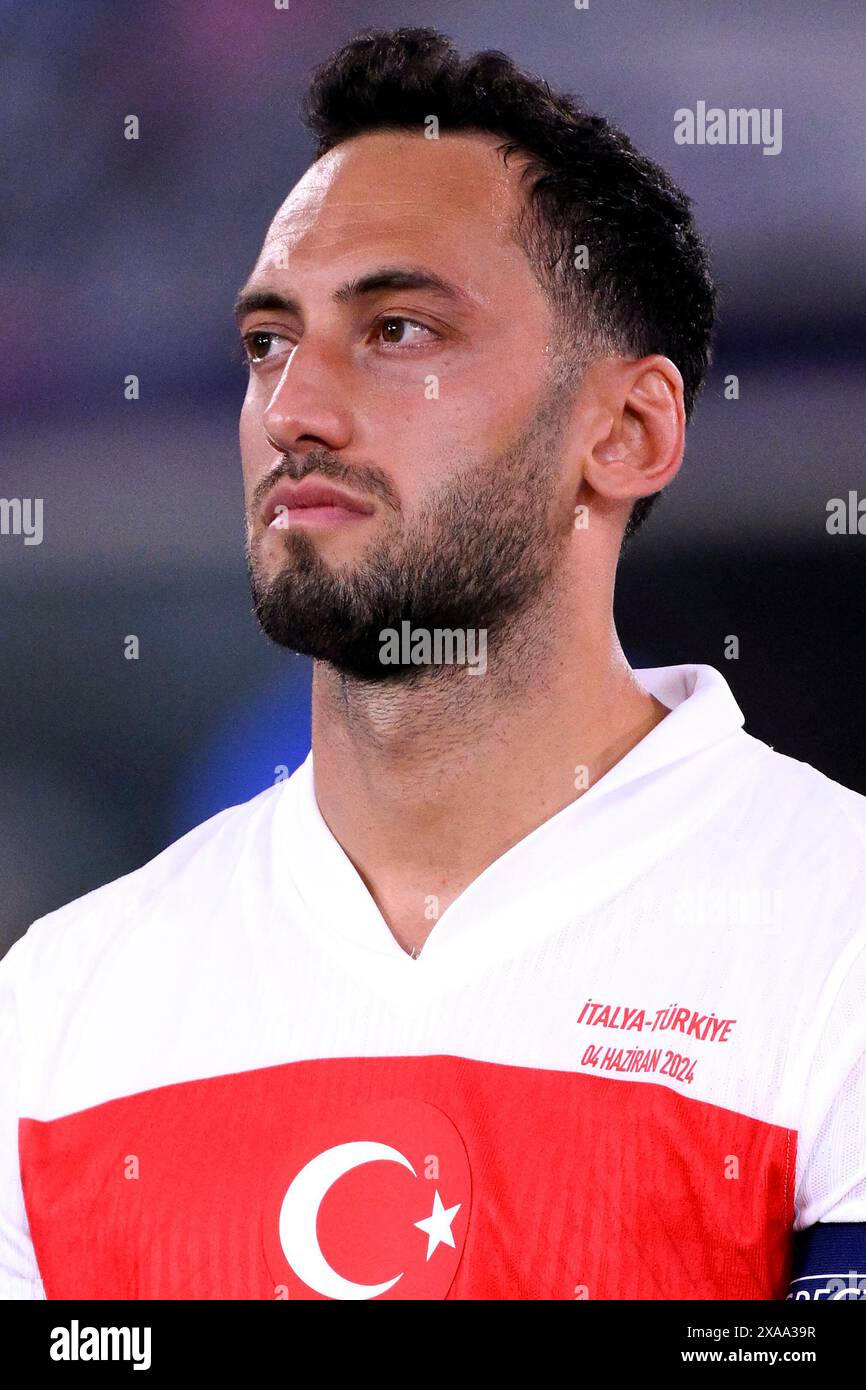 Hakan Calhanoglu of Turkey looks on during a friendly football match ...
