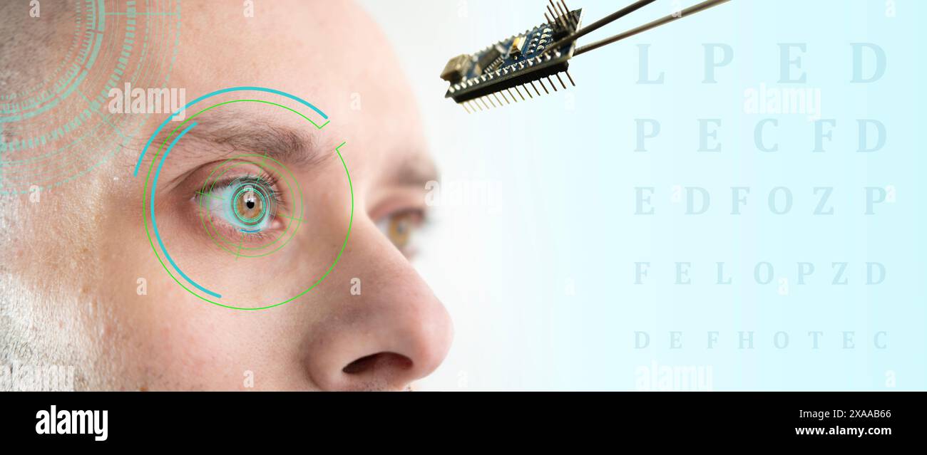 Installing electronic chip into human bionic, neuroprosthetic eye ...