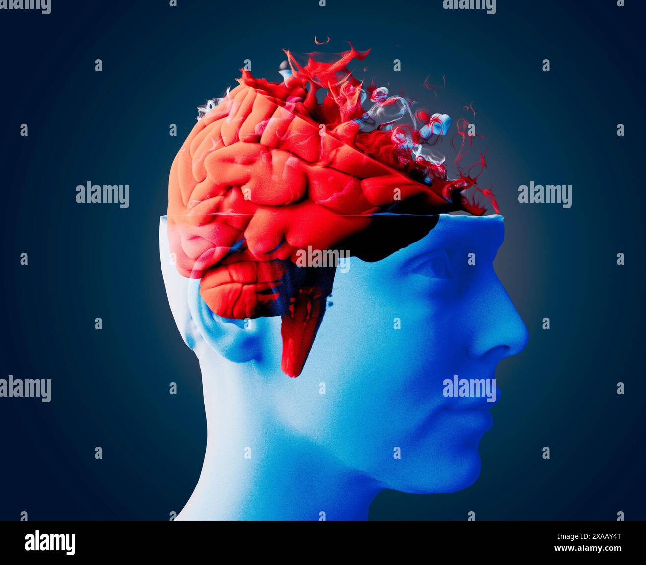 Face seen from the side. Memory lapses. Brain degenerative diseases ...