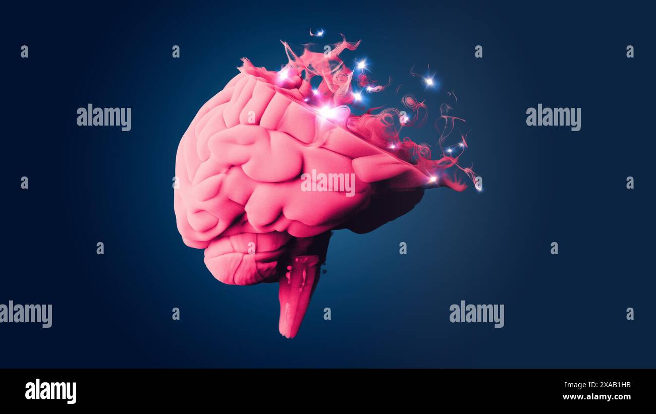 Brain seen from the side. Degenerative disease. Brain degenerative ...