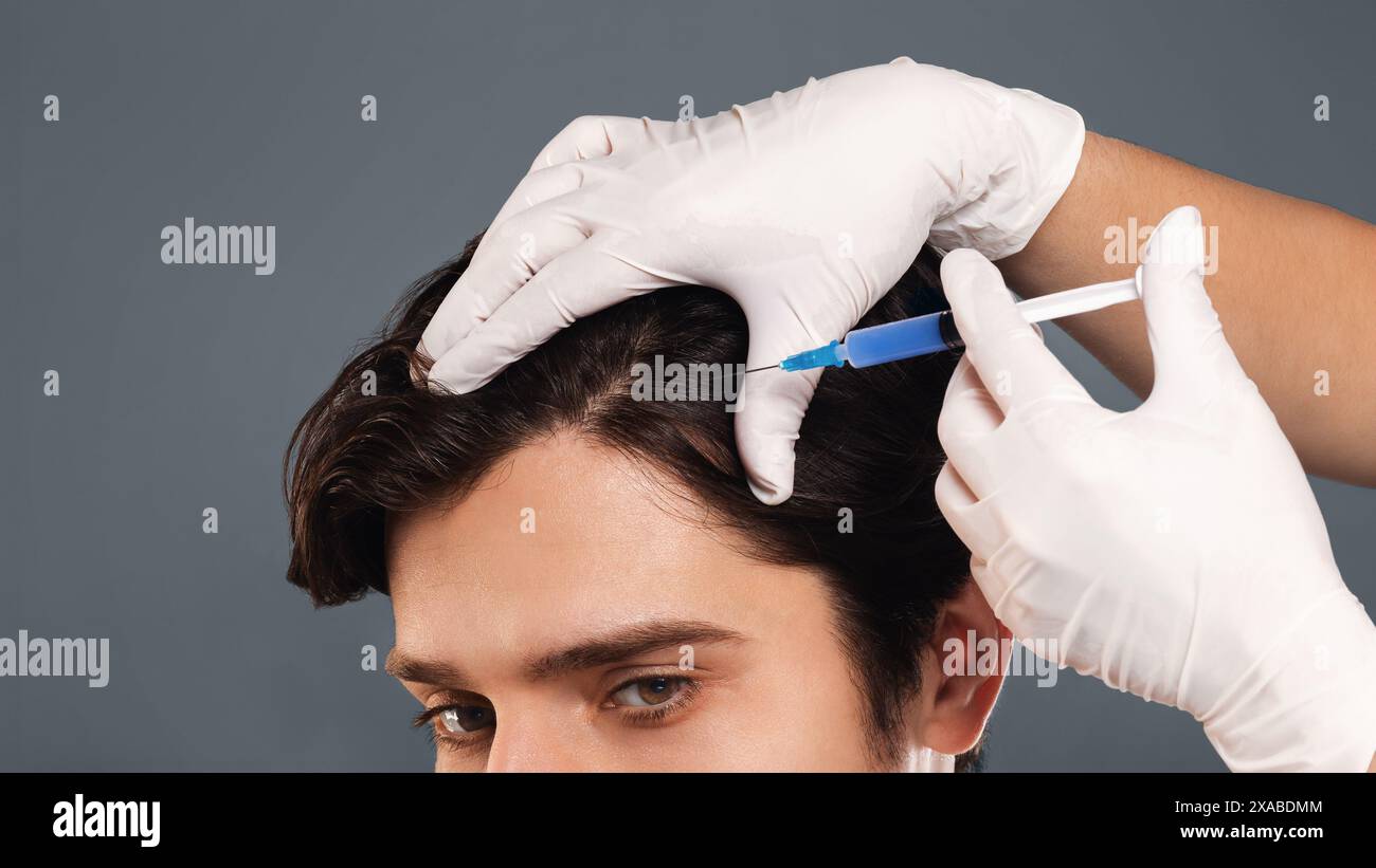 Hair loss injections hi-res stock photography and images - Alamy