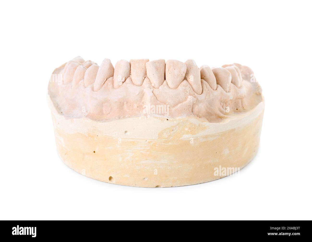 Dental model with jaw isolated on white. Cast of teeth Stock Photo - Alamy