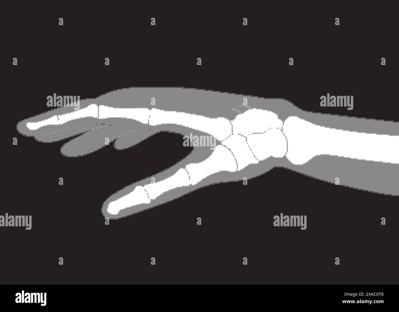 Vector illustration of a hand X-ray Stock Vector Image & Art - Alamy