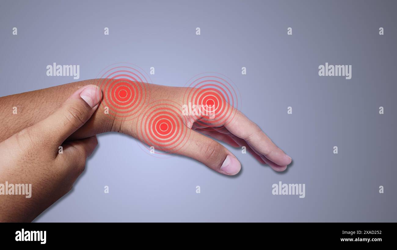 Muscle nerve in arm hi-res stock photography and images - Alamy