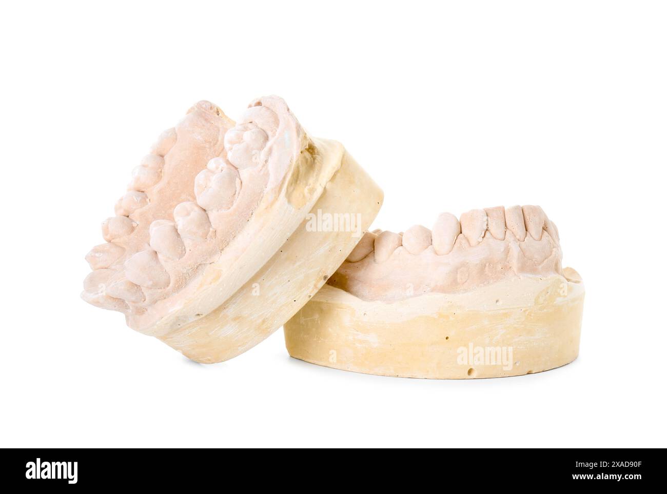 Dental model with jaws isolated on white. Cast of teeth Stock Photo - Alamy
