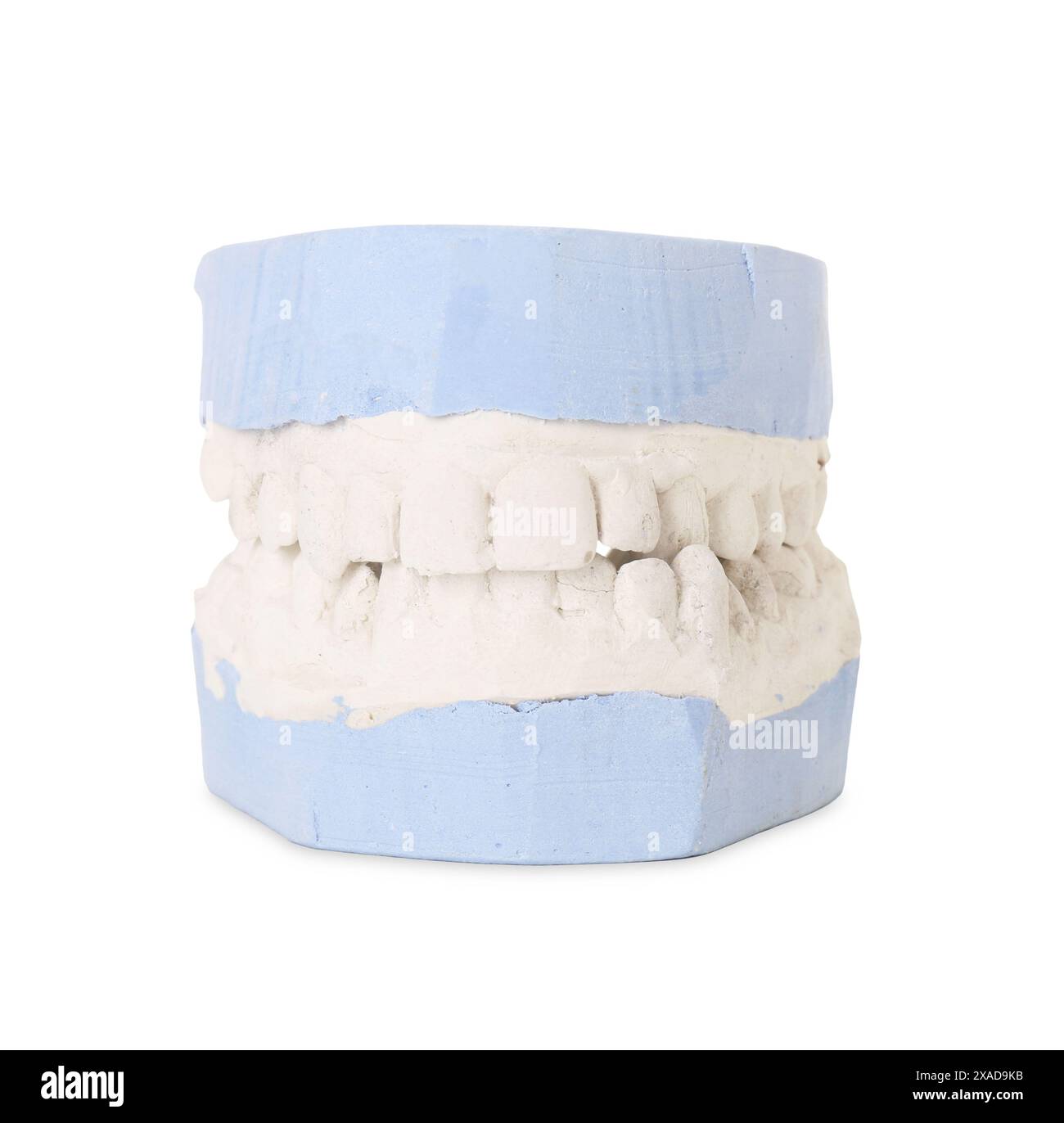 Dental model with gums isolated on white. Cast of teeth Stock Photo - Alamy