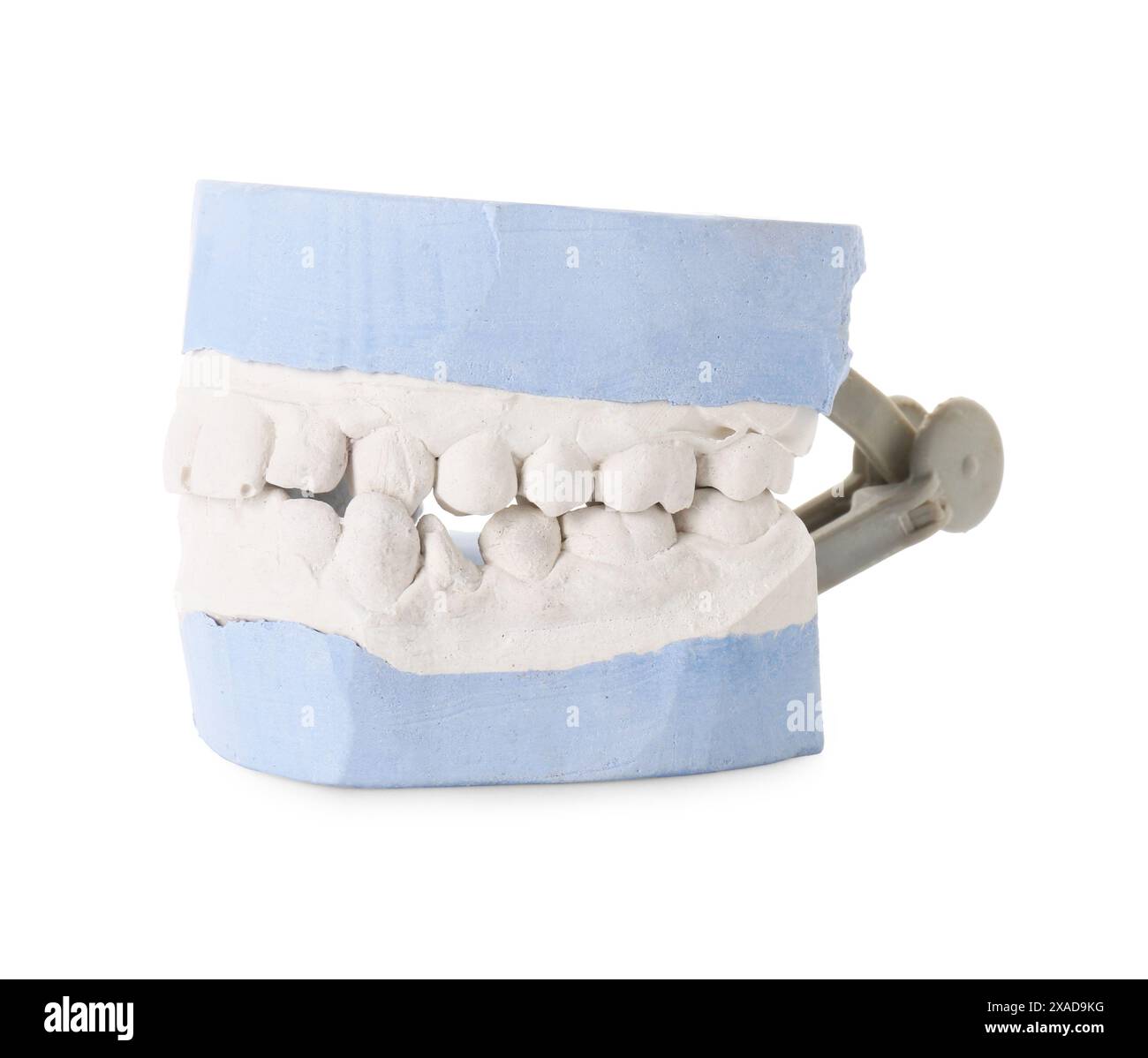 Dental model with gums isolated on white. Cast of teeth Stock Photo - Alamy