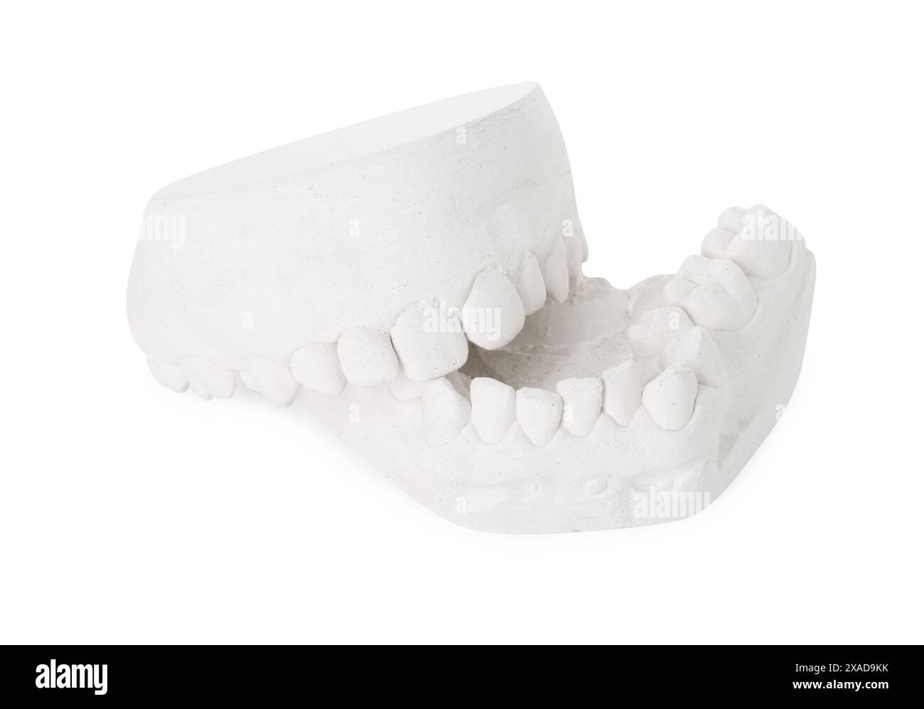 Dental model with gums isolated on white. Cast of teeth Stock Photo - Alamy