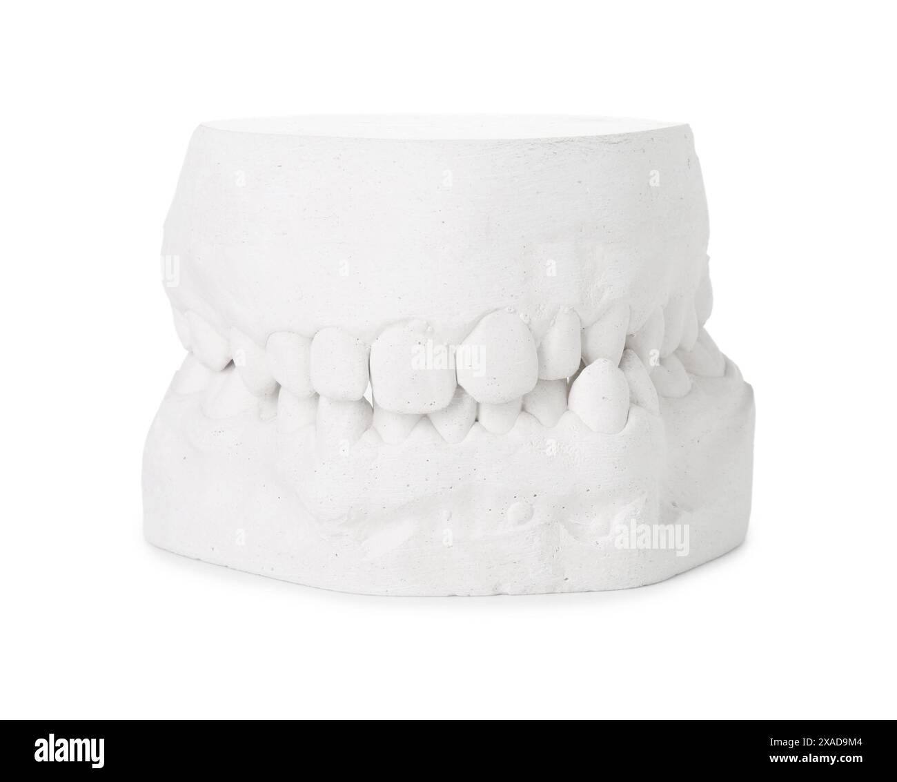 Dental model with gums isolated on white. Cast of teeth Stock Photo - Alamy