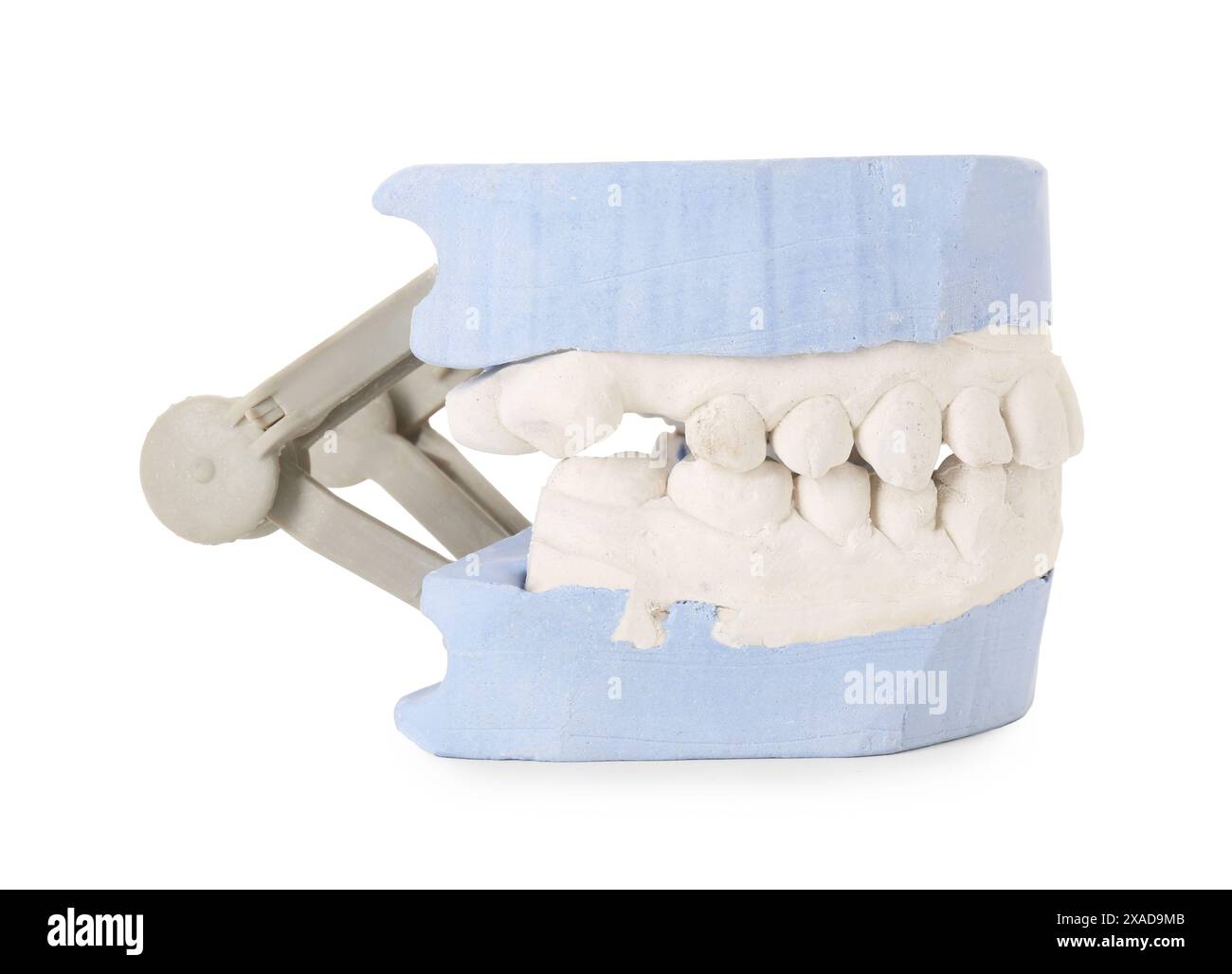 Dental model with gums isolated on white. Cast of teeth Stock Photo - Alamy