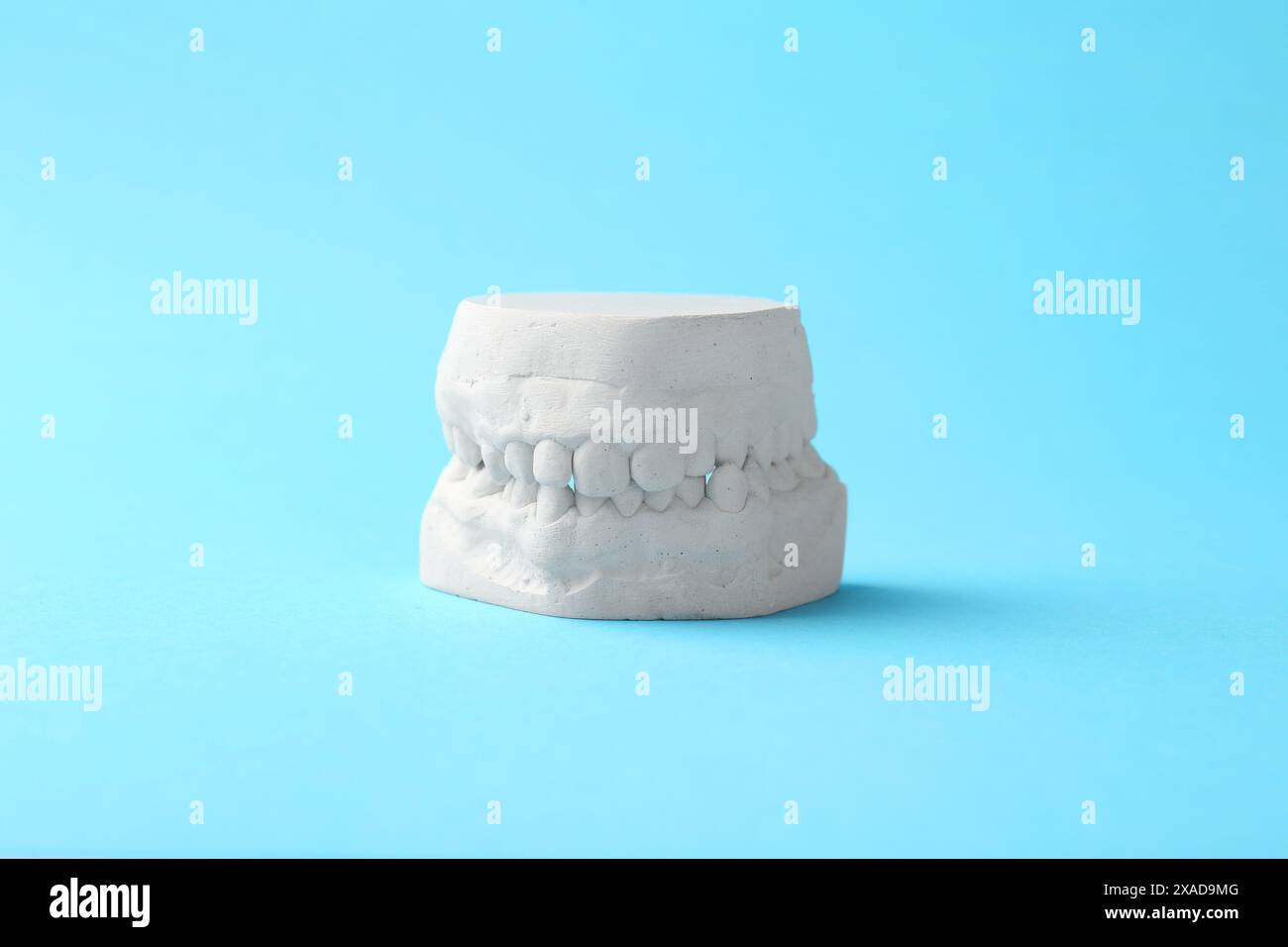 Dental model with gums on light blue background. Cast of teeth Stock ...