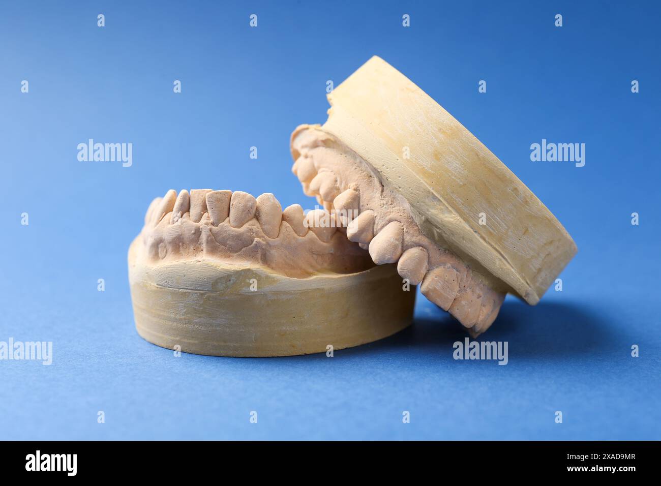 Dental model with gums on blue background. Cast of teeth Stock Photo ...