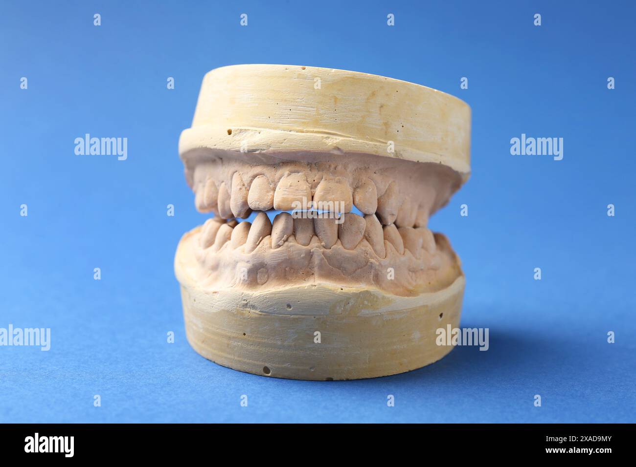 Dental model with gums on blue background. Cast of teeth Stock Photo ...