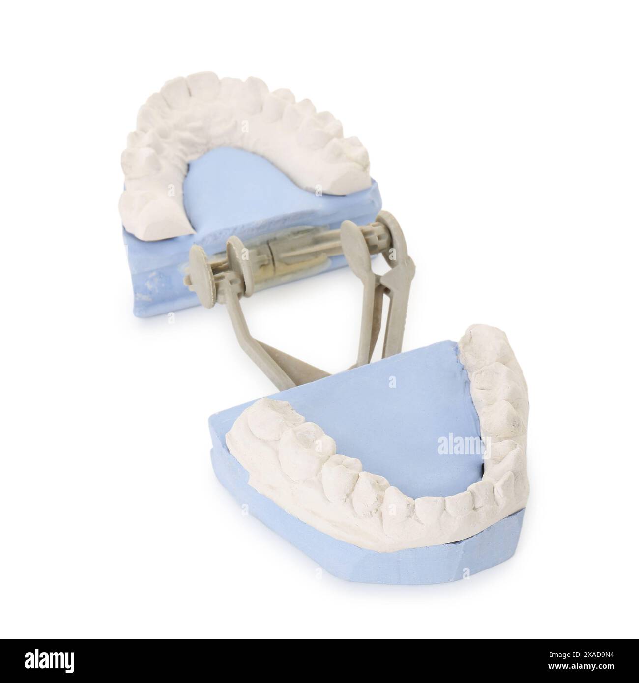 Dental model with gums isolated on white. Cast of teeth Stock Photo - Alamy