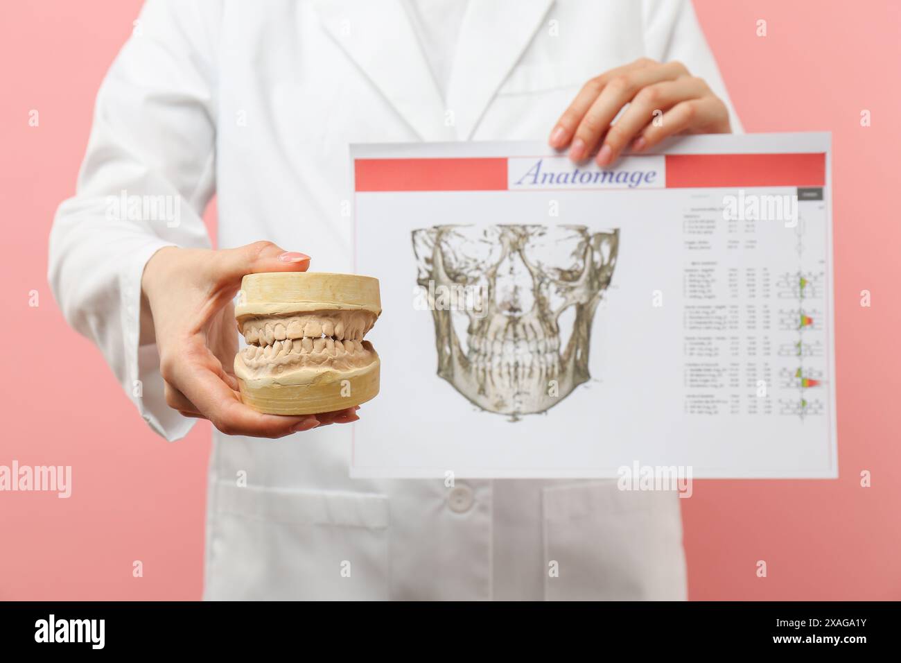 Doctor holding dental model with jaws and visualization of human ...