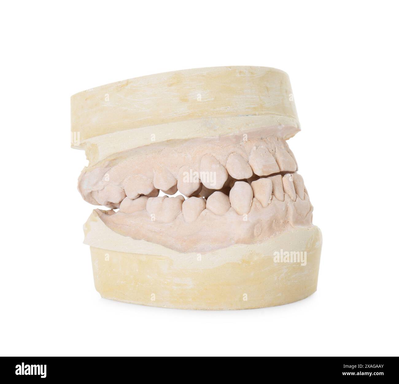 Dental model with jaws isolated on white. Cast of teeth Stock Photo - Alamy