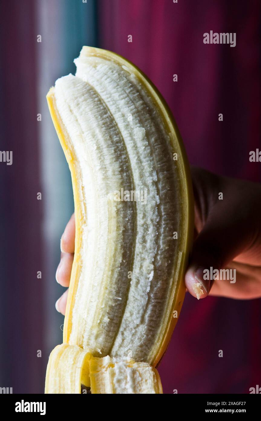 Conjoined twins hi-res stock photography and images - Alamy