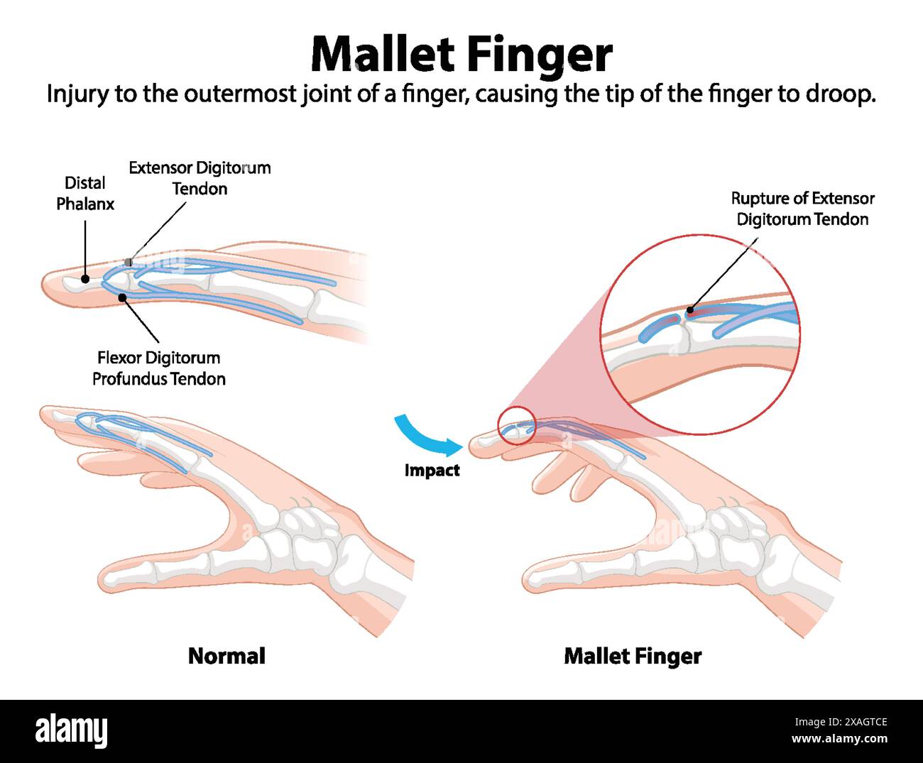 Orthopedic medical conditions hi-res stock photography and images - Alamy