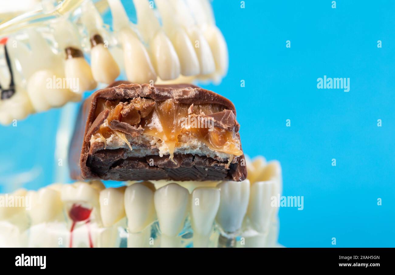 A bitten chocolate bar in a dental jaw mockup on a blue background. The ...
