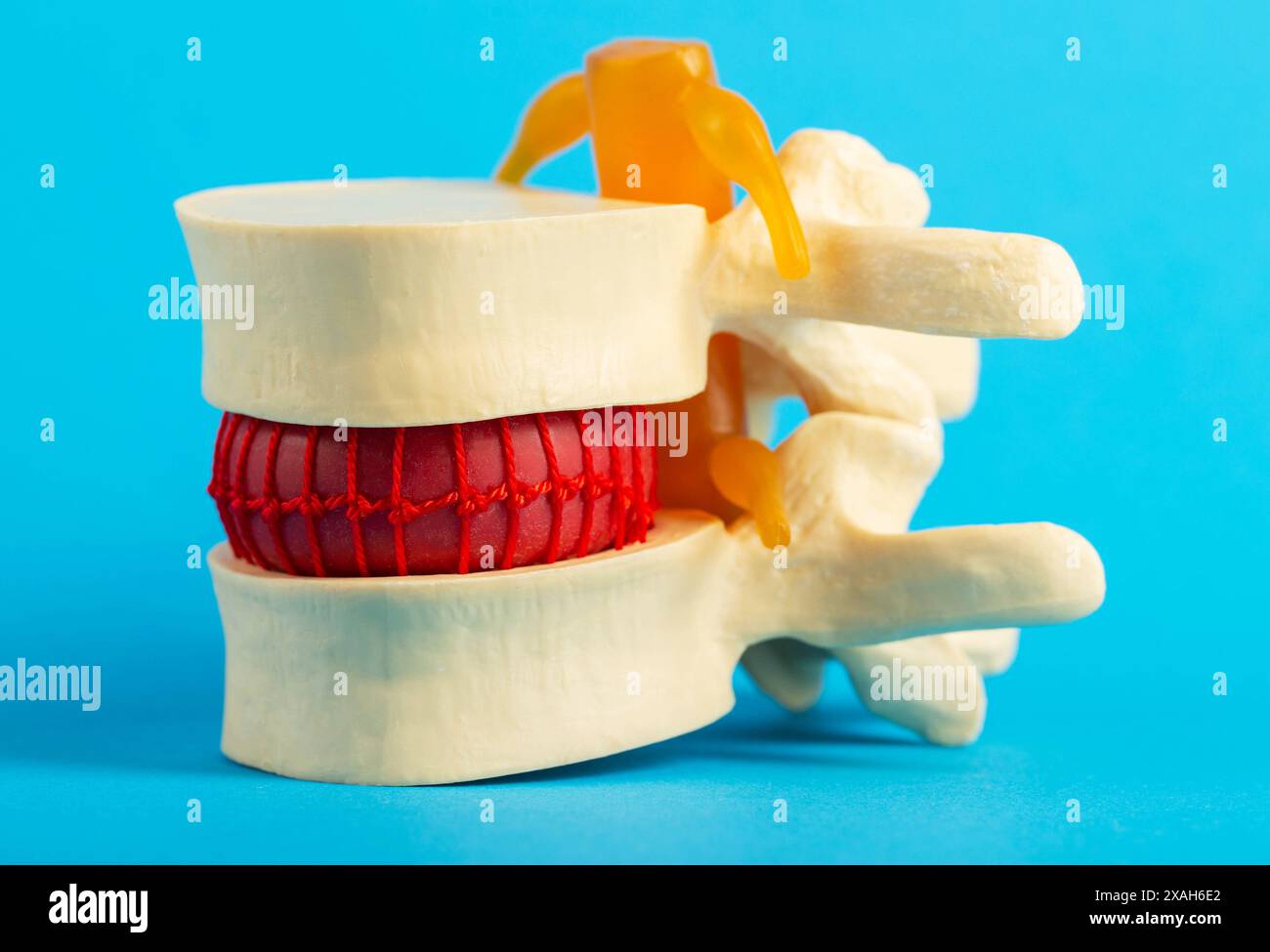 Medical model of the spine on a blue background, close-up. The concept ...